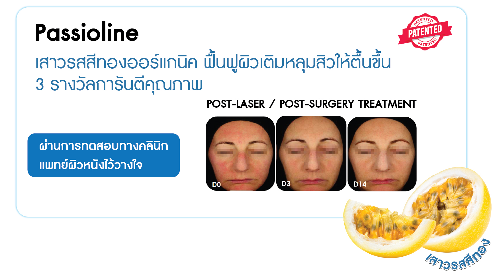 Passioline สารสกัดน้ำมันเสาวสสีทองจากเปรู อุดมไปด้วยโทโคไตรอีนอล ช่วยซ่อมแซม ฟื้นฟู และปลอบ ...
