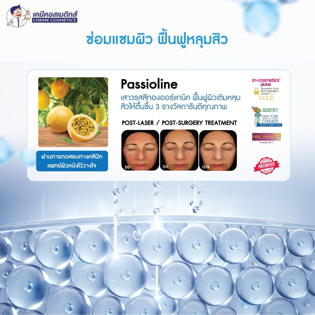 💥 สิวจะหาย ต้องฉีดอีกกี่ครั้ง? หรือแค่ใช้สารออกฤทธิ์ดีๆ ก็จบ! - เคมีคอสเมติกส์